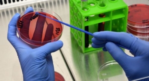 Antimicrobial Resistance | Food and Agriculture Organization of the ...