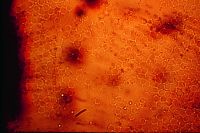 PHOTO LIBRARY: detail